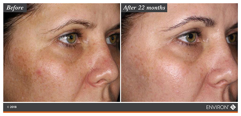 Environ Radiance + Mela Fade Serum System x2 30ml – The Facial Room