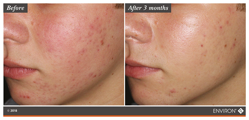 Environ Clarity+ Sebu Clear Masque 50ml – The Facial Room